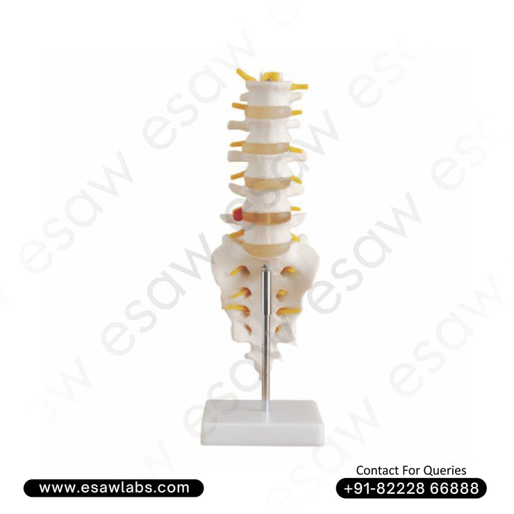 Life-Size Lumbar Vertebrae with Sacrum, Coccyx & Herniated Disc Model
